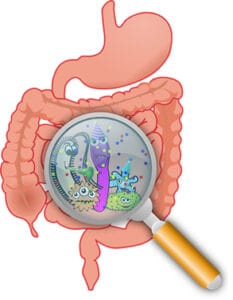 Disbiose Intestinal. Já Ouviu Falar? - Super Nutrição